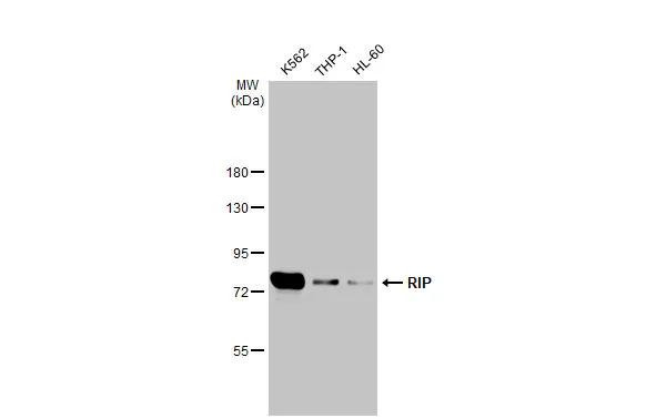 RIP1 Recombinant Monoclonal Antibody (HL2250) (MA5-50456)