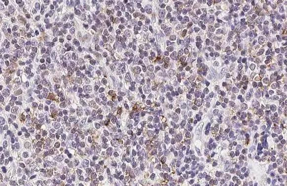 TNF alpha Recombinant Monoclonal Antibody (HL2361) (MA5-50504)