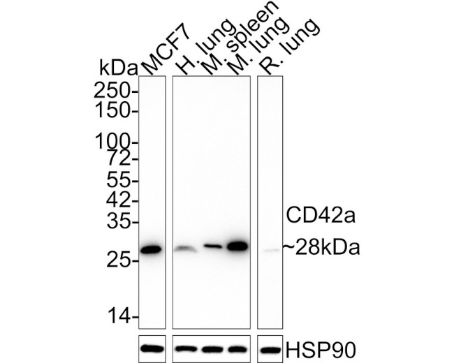 CD42a Monoclonal Antibody (A5E6) (MA5-50570)
