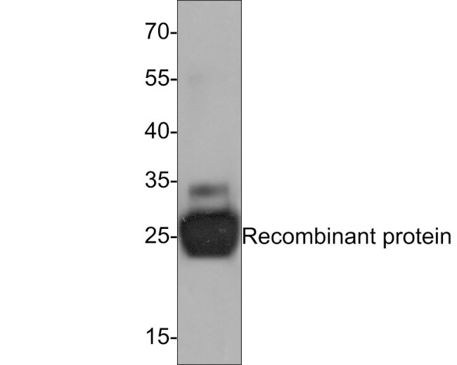IL-6 Monoclonal Antibody (A6D2) (MA5-50599)