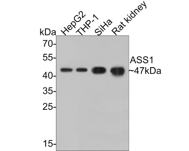 ASS1 Recombinant Monoclonal Antibody (11F1-RA) (MA5-50643)