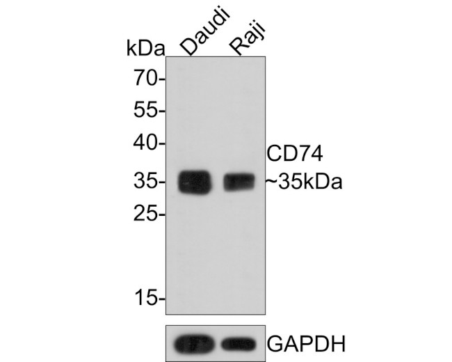 CD74 Recombinant Monoclonal Antibody (PDM0-22) (MA5-50652)