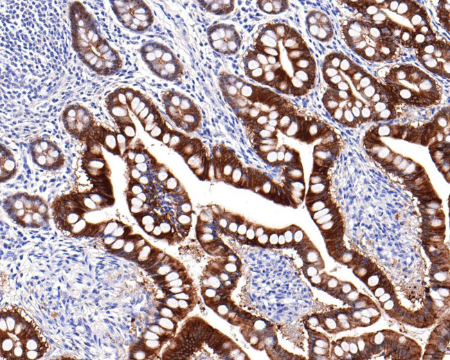 Villin Recombinant Monoclonal Antibody (C4) (MA5-50677)