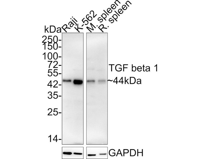TGF beta-1 Recombinant Monoclonal Antibody (PD00-17) (MA5-50685)