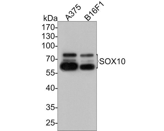SOX10 Recombinant Monoclonal Antibody (PDH0-05) (MA5-50753)