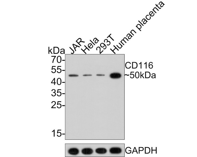 CD116 Recombinant Monoclonal Antibody (JE61-37) (MA5-50762)
