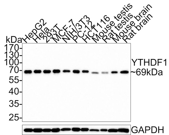 YTHDF1 Recombinant Monoclonal Antibody (PSH0-23) (MA5-50793)