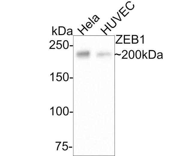 ZEB1 Recombinant Monoclonal Antibody (JE57-64) (MA5-50808)