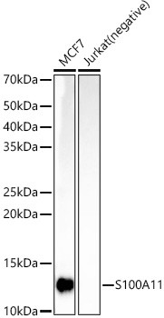 S100A11 Recombinant Monoclonal Antibody (8U1Y8) (MA5-51258)