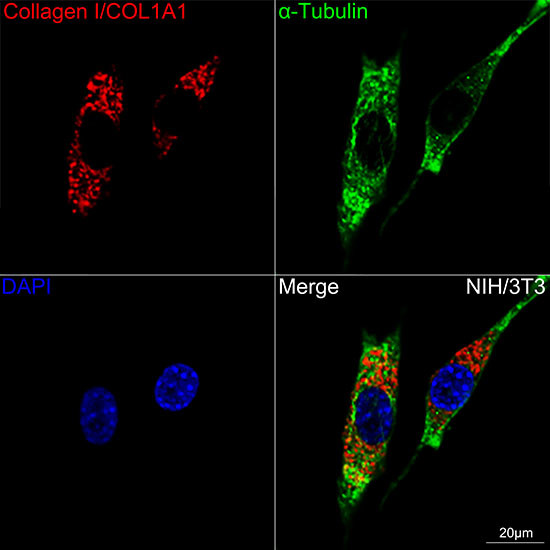 COL1A1 Recombinant Monoclonal Antibody (8G5A3) (MA5-51349)
