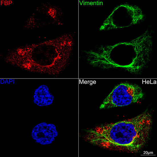 Folate Receptor alpha Recombinant Monoclonal Antibody (6A8A10) (MA5-51425)