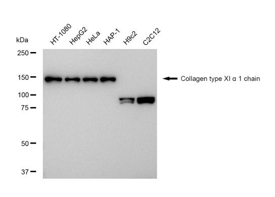 COL11A1 Recombinant Monoclonal Antibody (23GB5100) (MA5-52790)