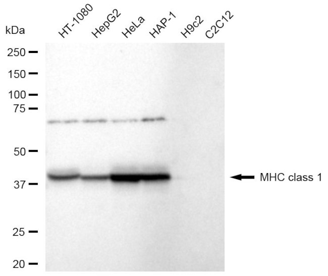MHC Class I Recombinant Monoclonal Antibody (23GB6515) (MA5-53058)