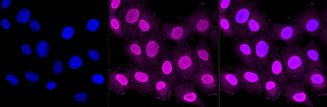 Annexin V Recombinant Monoclonal Antibody (23GB650) (MA5-54184)