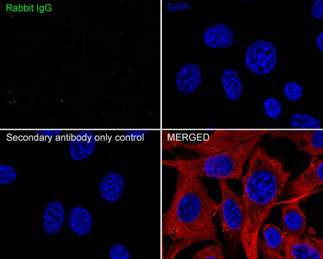 Rabbit IgG Recombinant Monoclonal Antibody (PSH04-42) (MA5-56524)
