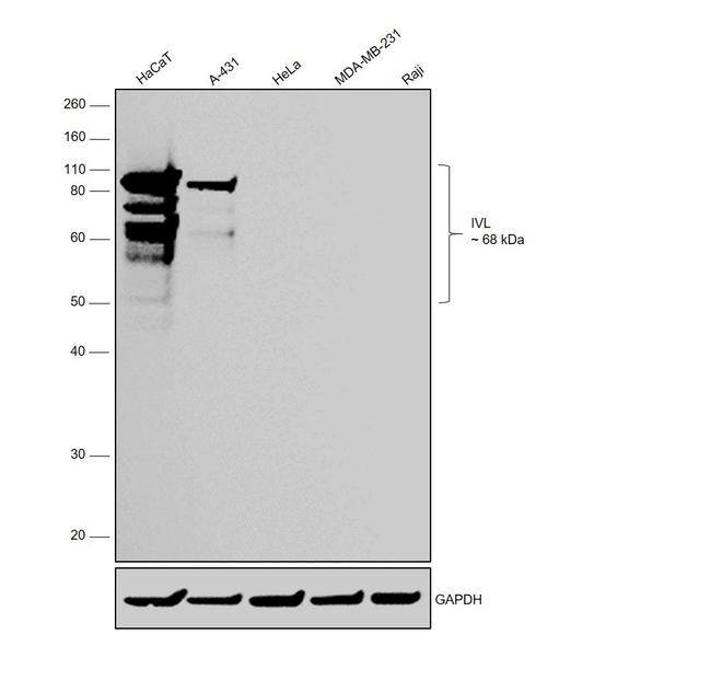 Involucrin Monoclonal Antibody (SY5) (MA5-11803)