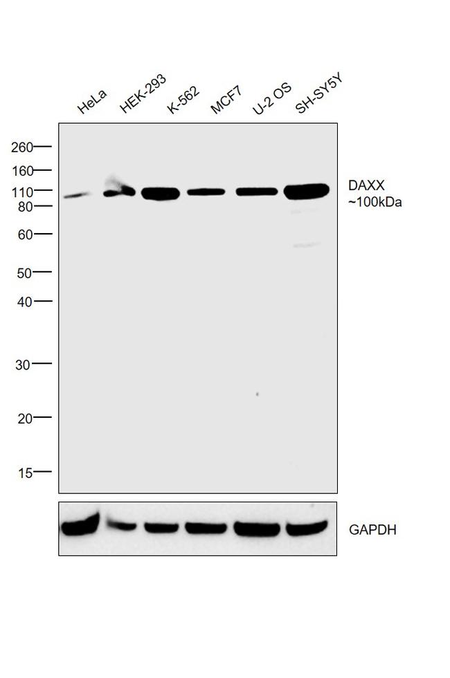 DAXX Monoclonal Antibody (7A11) (MA5-15552)