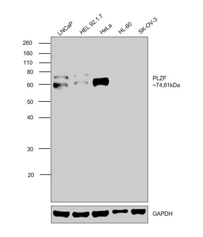 PLZF Antibody (MA5-15667)