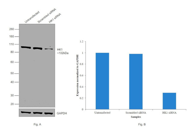 HK1 Antibody (MA5-15675)