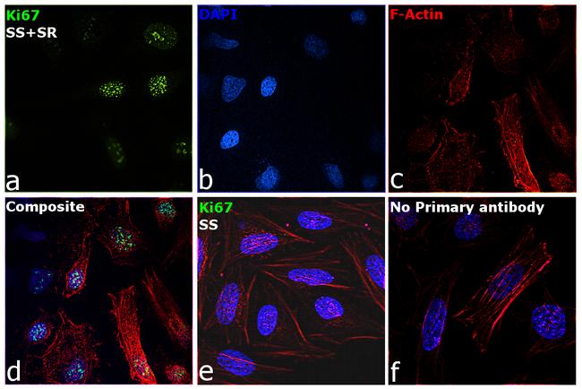 Ki-67 Antibody (MA5-15690)
