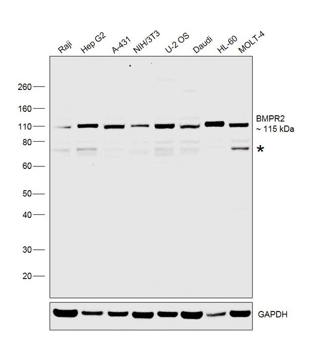 BMPR2 Monoclonal Antibody (3F6F8) (MA5-15827)