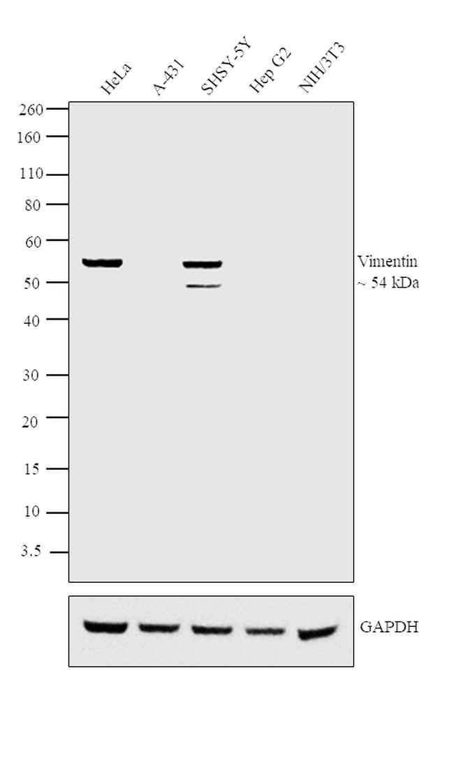 Vimentin Monoclonal Antibody (SP20) (MA5-16409)