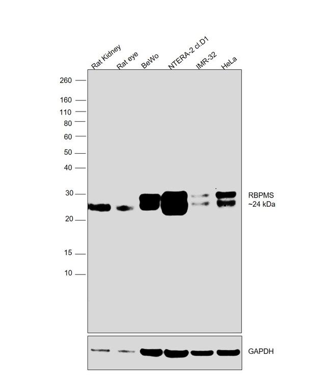 RBPMS Antibody (MA5-26396)