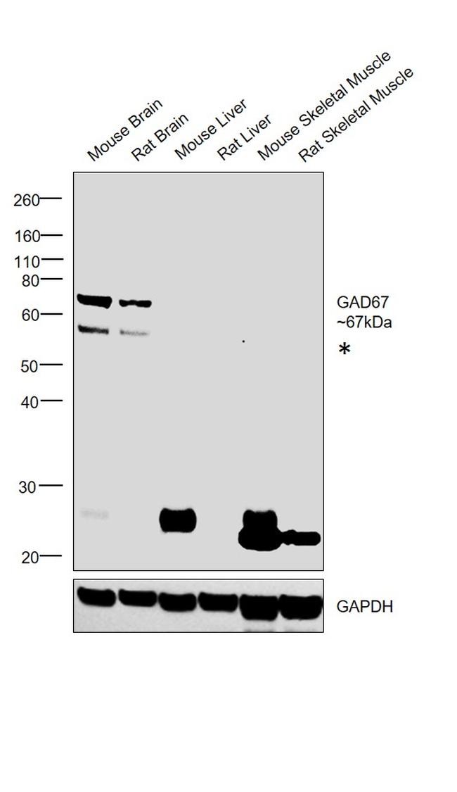GAD67 Monoclonal Antibody (GT1982) (MA5-27817)