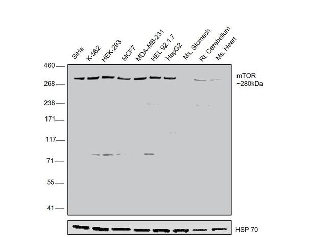 mTOR Antibody (MA5-31505)