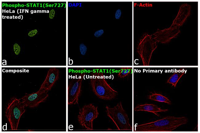Phospho-STAT1 (Ser727) Antibody (MA5-32271)