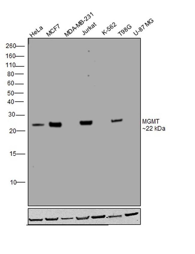 MGMT Antibody (MA5-32461)