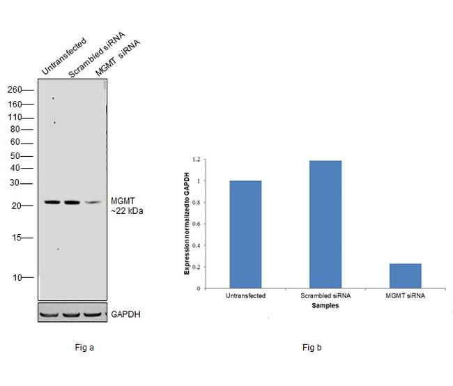 MGMT Antibody (MA5-32461)