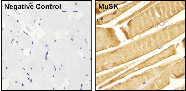 MUSK Antibody (PA1-1741)