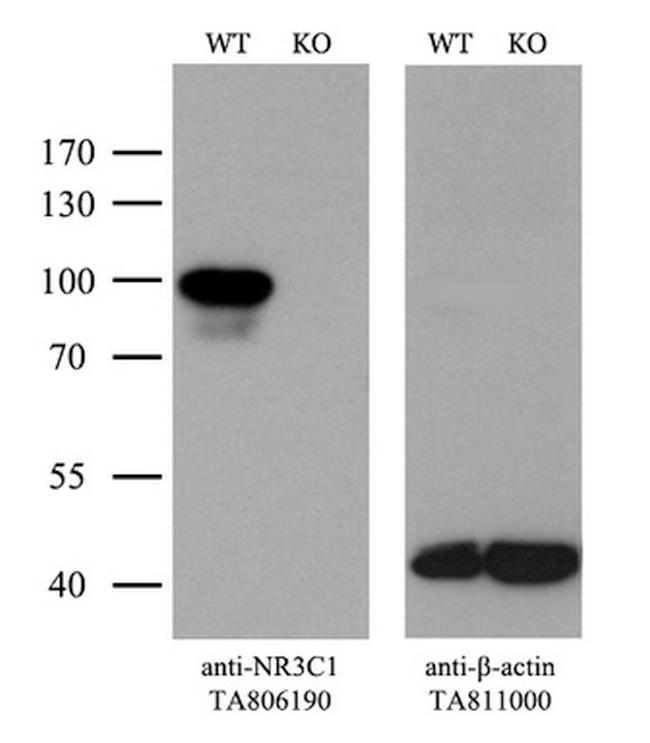 NR3C1 Antibody (CF806190)