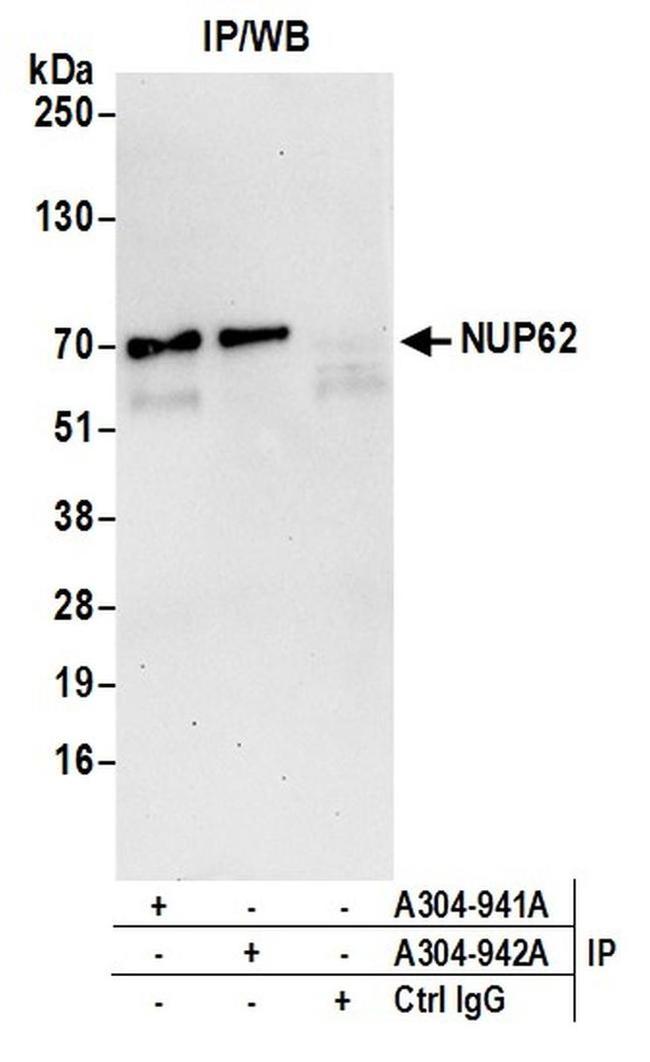 Nucleoporin p62/NUP62 Antibody (A304-941A)