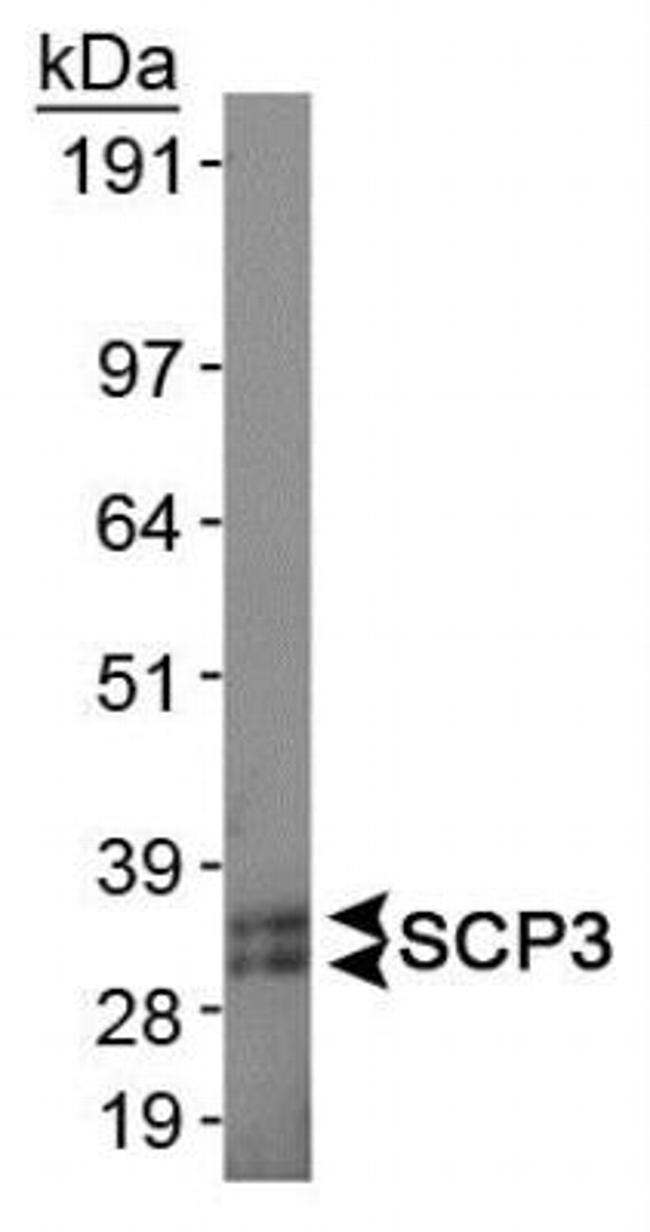 SCP3 Antibody (PA1-16766)