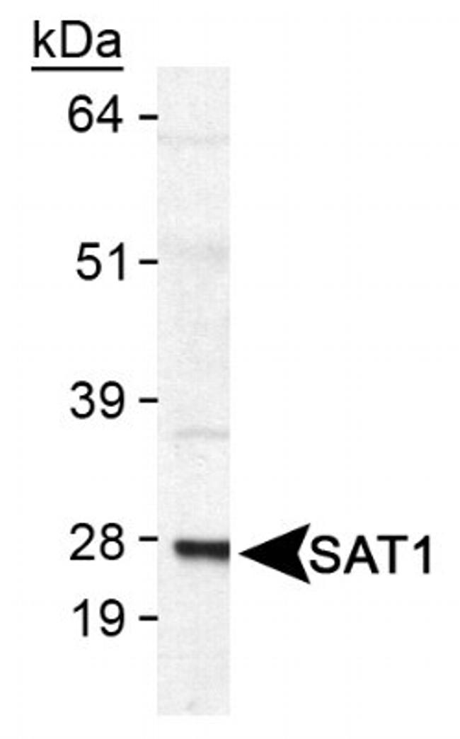SAT1 Antibody (PA1-16992)