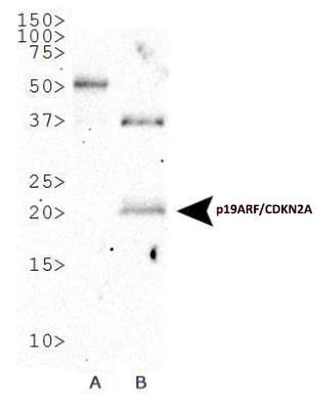 p16INK4a Antibody (PA1-46220)