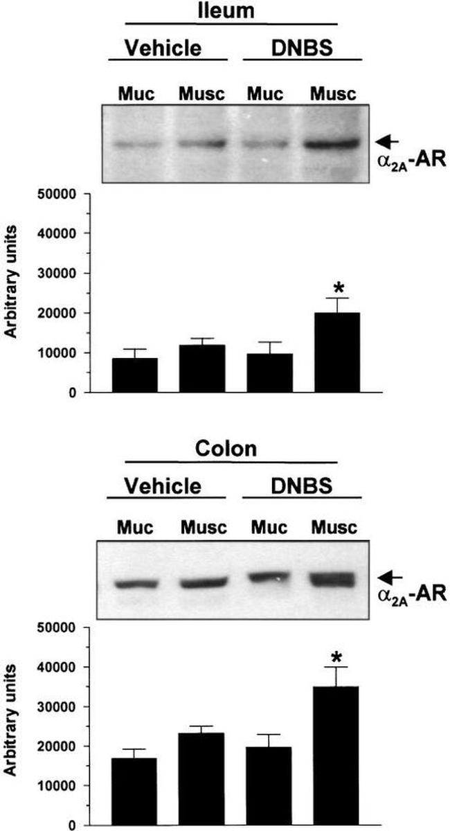alpha-2a Adrenergic Receptor Antibody (PA1-048)