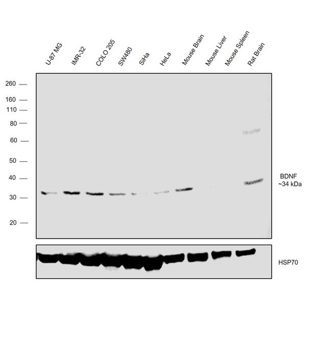 BDNF Polyclonal Antibody (PA1-18372)