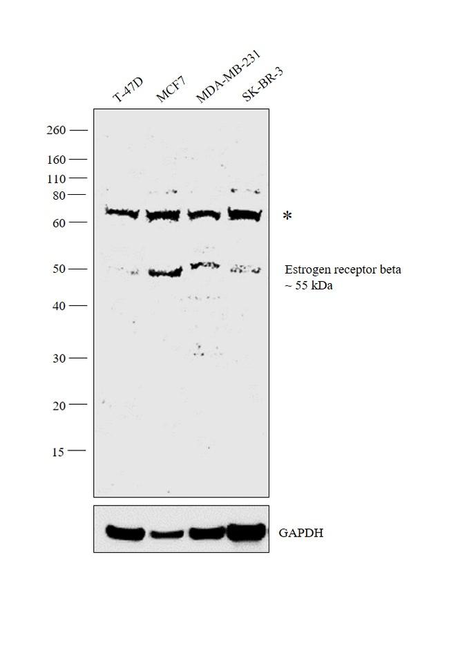 Estrogen Receptor beta Polyclonal Antibody (PA1-313)