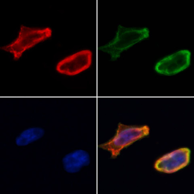 VNN1 Antibody (PA5-100085)
