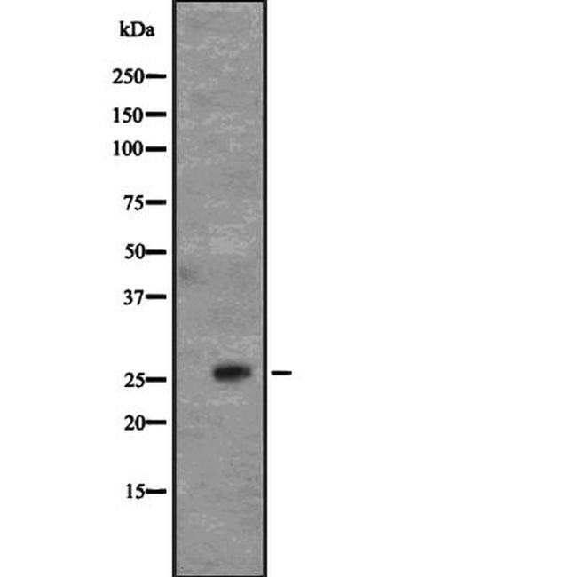 CD63 Polyclonal Antibody (PA5-100713)
