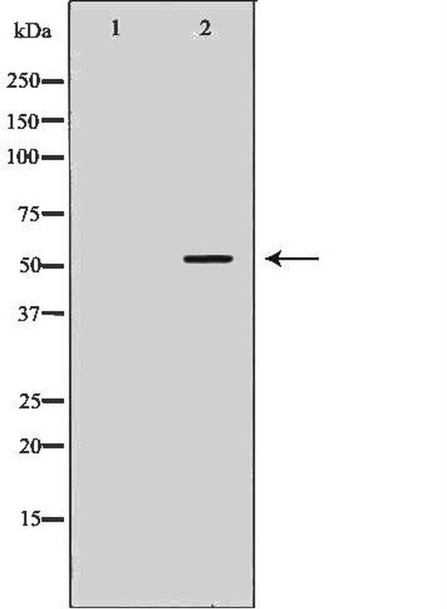 STEAP3 Polyclonal Antibody (PA5-102321)