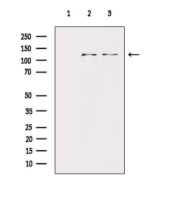 Phospho-PERK (Thr982) Polyclonal Antibody (PA5-102853)