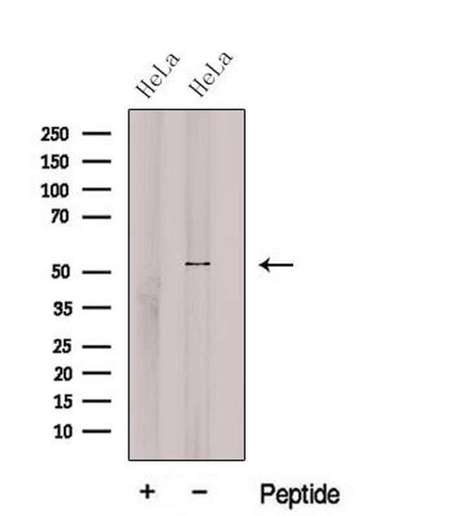 cGAS Polyclonal Antibody (PA5-104340)