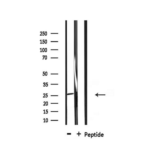 CHOP Antibody (PA5-104528)