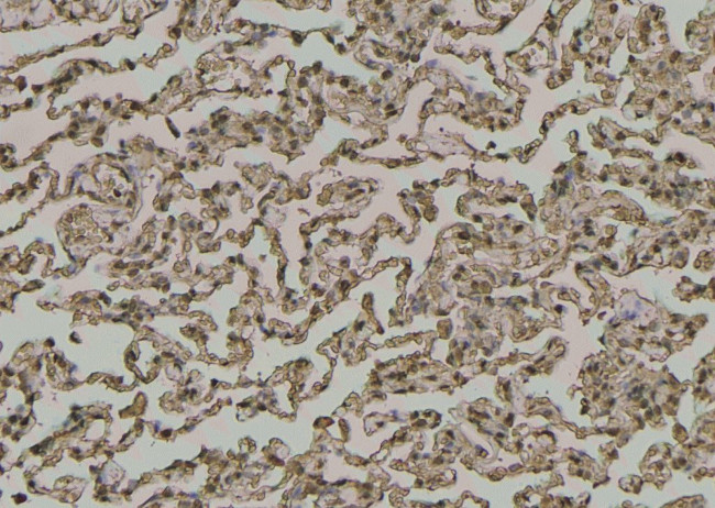 Phospho-STING (Ser366) Antibody (PA5-105674)