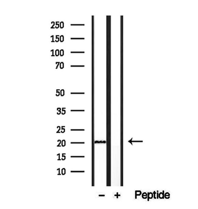 Centrin 2 Antibody (PA5-106344)