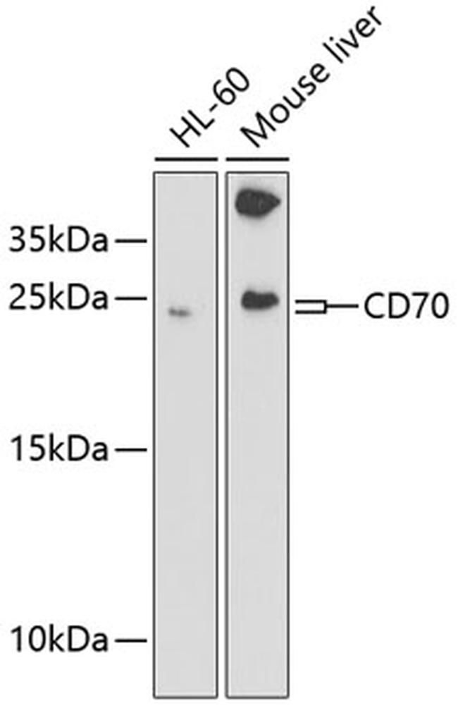 CD70 Antibody (PA5-109498)